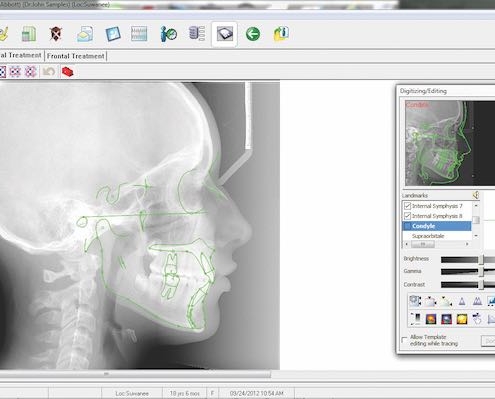 imaging – orthotrac